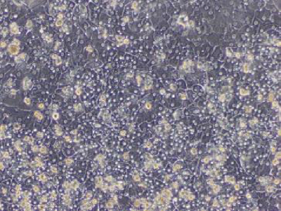 PXB-cells | 株式会社フェニックスバイオ