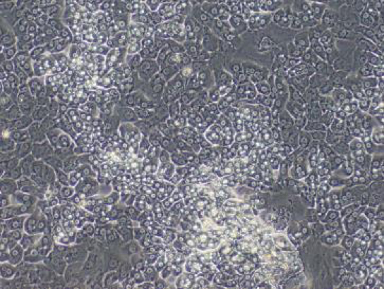 PXB-cells | 株式会社フェニックスバイオ